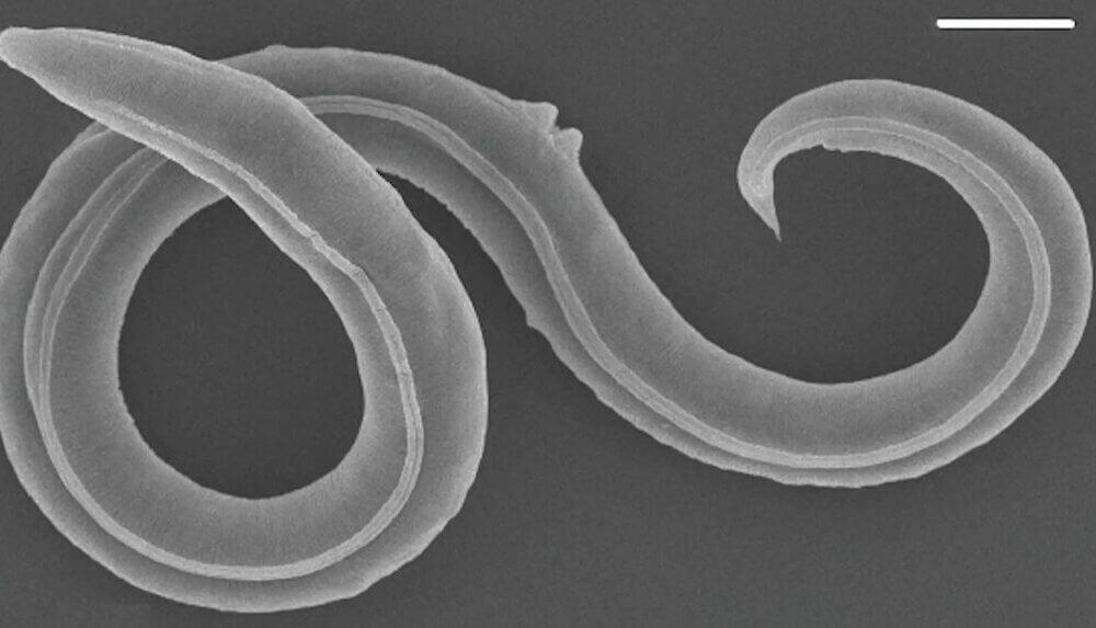 How A Russian Researcher Revived A 46,000 Years Old Worm From Permafrost